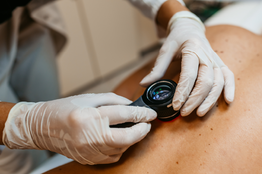 Know Before You Go: What to Expect During a Skin Cancer Check | Tufts ...